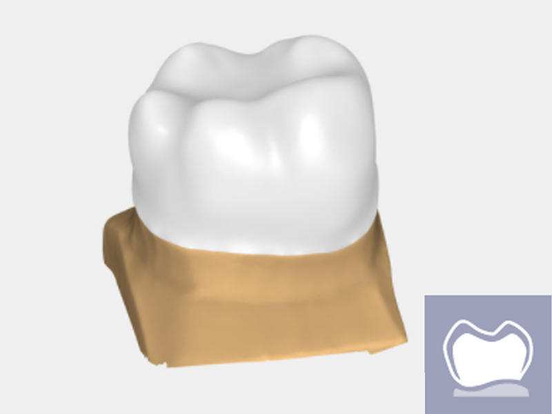 Dental CAD Software